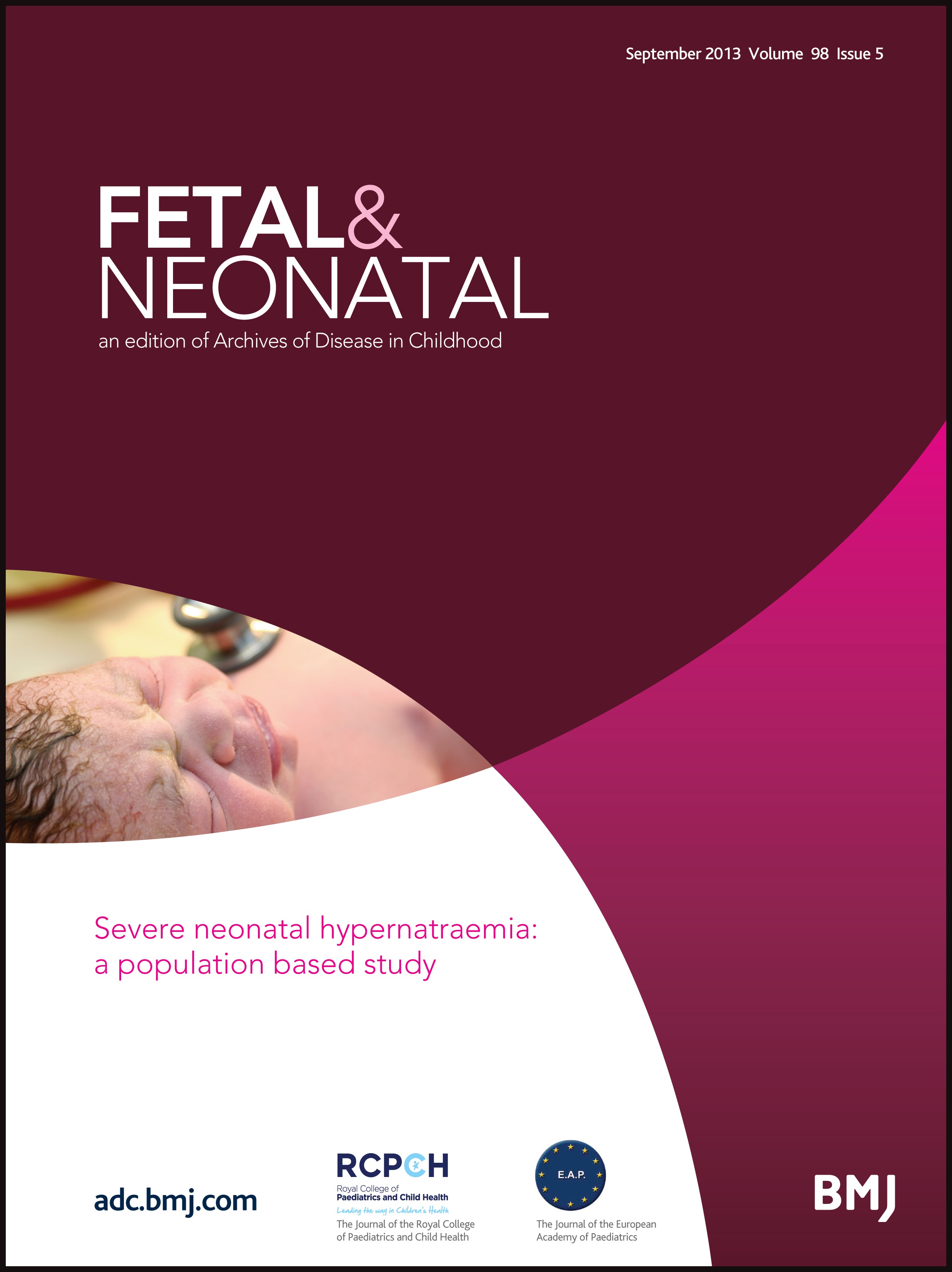Bohn's nodules: an under-recognised entity | ADC Fetal & Neonatal Edition